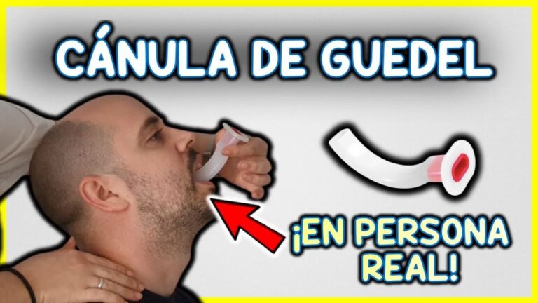 Cánula de Guedel: ¿Para Qué Sirve y Cuándo Utilizarla? - CarlaPeraza.es ...