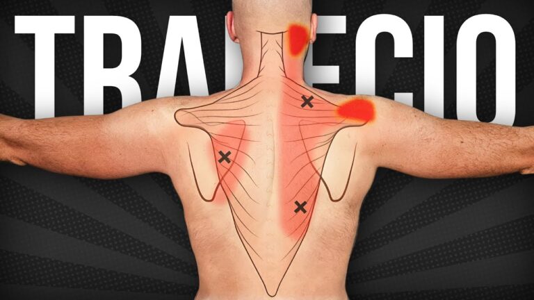 Cómo Aliviar el Dolor en el Trapecio y Cuello: Causas, Síntomas y ...