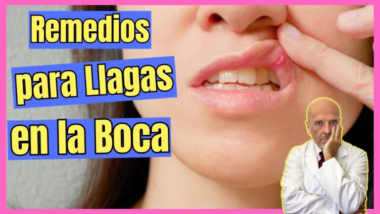 ¿Qué Tomar para Aliviar las Llagas en el Cielo de la Boca? Guía ...