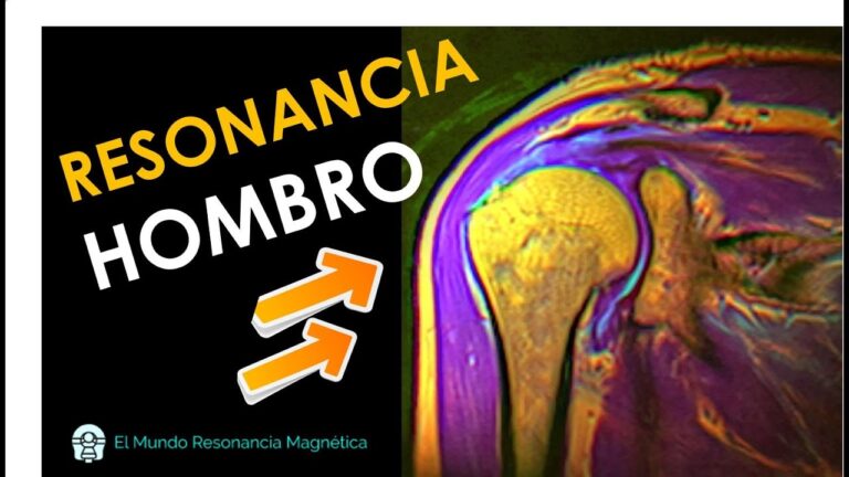 Resonancia Magnética de Hombro: Todo sobre el Manguito Rotador y su ...